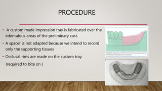 Functional impression in RPD | PPTX