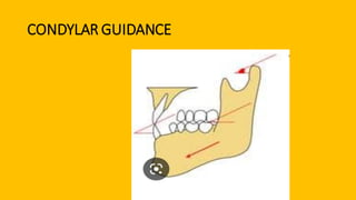 BALANCED OCCLUSION | PDF