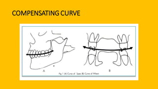 BALANCED OCCLUSION | PDF