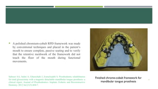 Prosthodontic Rehabilitation Using Magnetic Detachable Mandibular ...