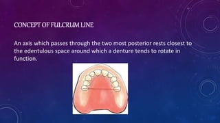 prostho seminar.pptx