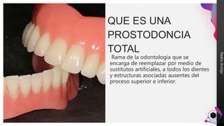 Prostodoncia total | PPTX