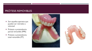 Prostodoncia i.pdf tipos de prótesis dental | PDF