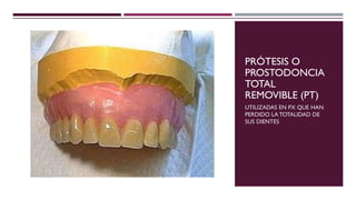 Prostodoncia i.pdf tipos de prótesis dental | PDF