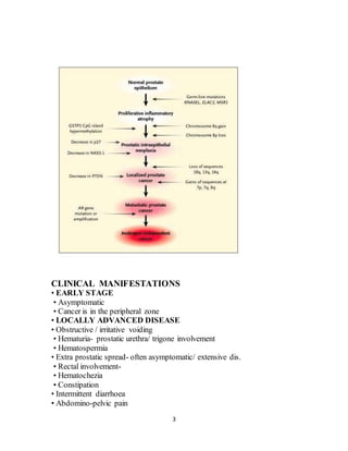 Prostrate cancer | DOCX