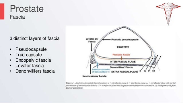 Prostrate pre managment ppt