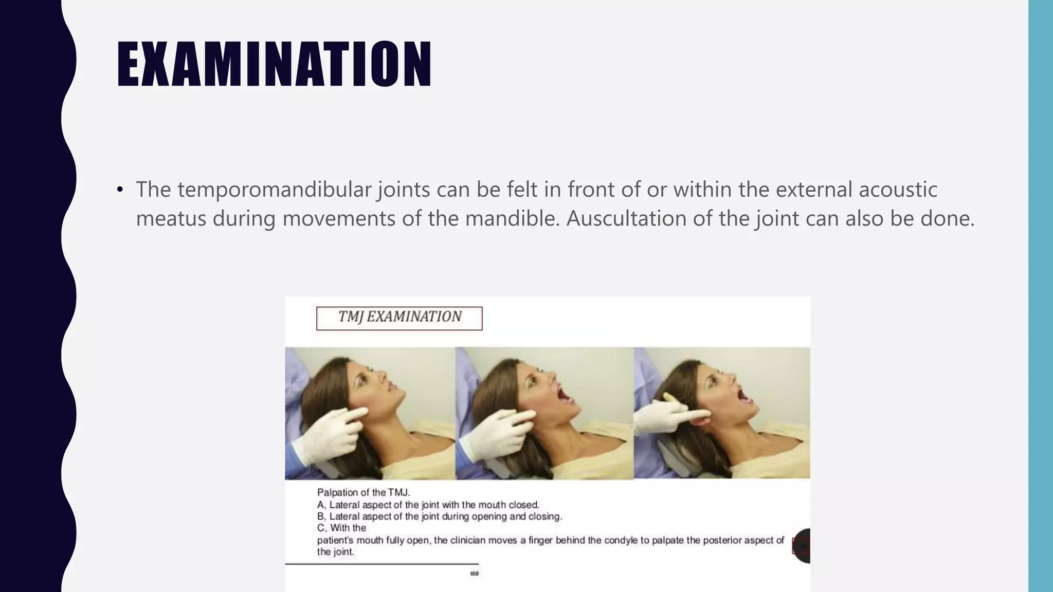 TMJ- Temporomandibular joint | PPT