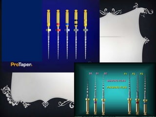 Protaper NiTi File System | PPTX