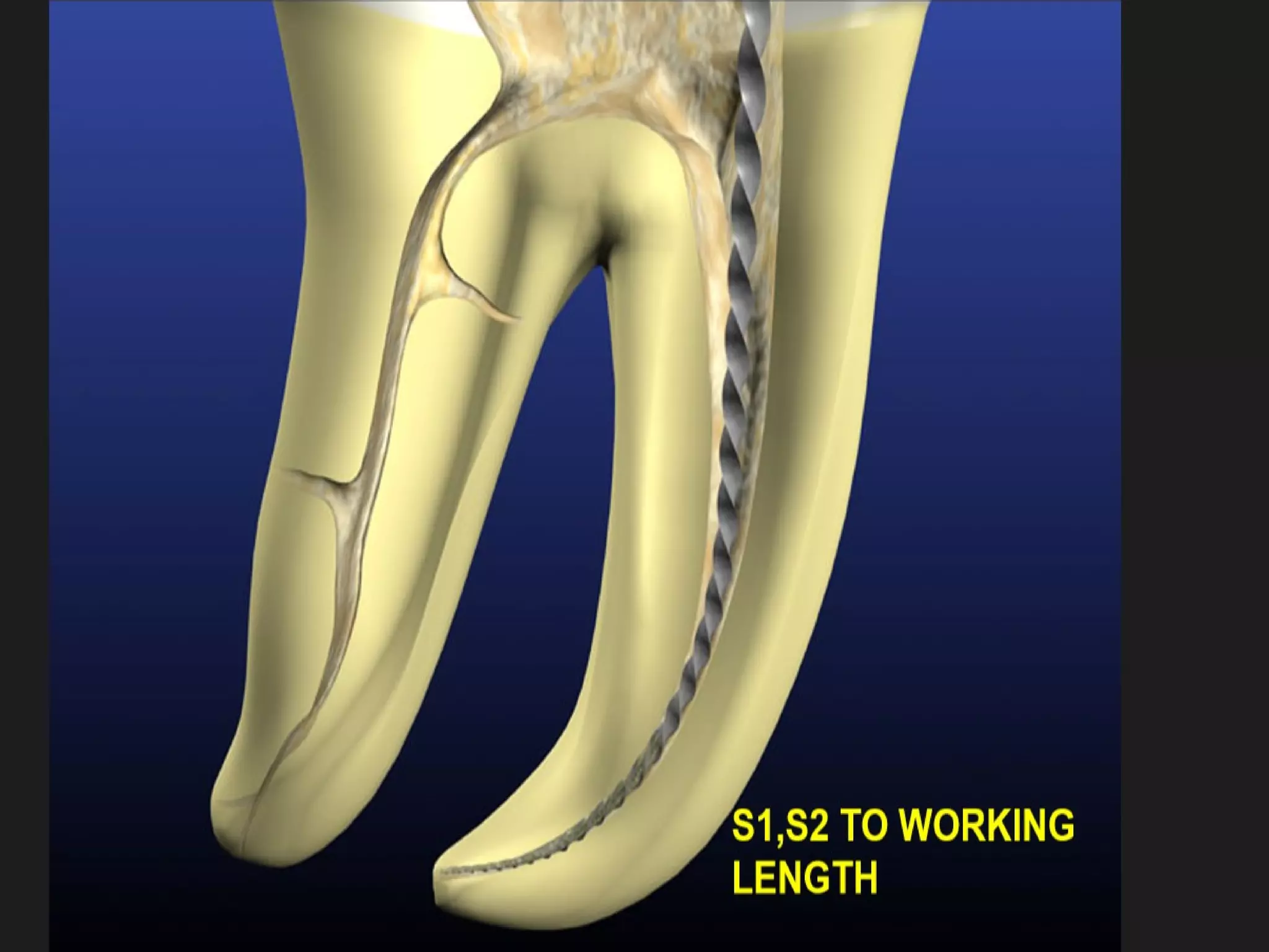 Protaper endodontic system | PPT