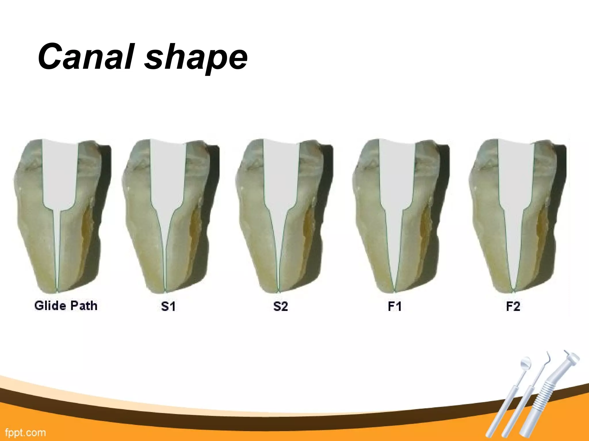 Protaper endodontic system | PPT