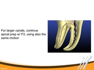 Protaper endodontic system | PPT