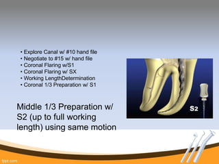 Protaper endodontic system | PPTX