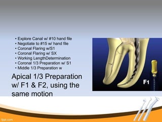 Protaper endodontic system | PPTX