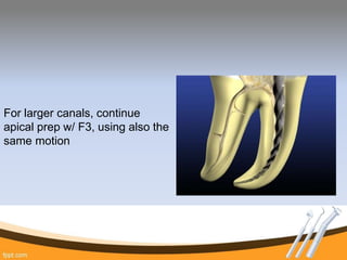 Protaper endodontic system | PPTX