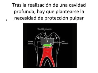 Proteccion pulpar | PPT