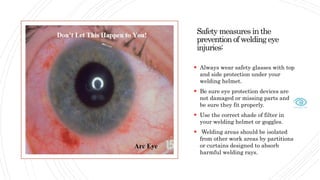 Protecting the eye from welding | PPTX