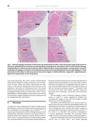 Protective Effect of Phyllanthus Amarus by Modulation of Endogenous Biomarkers and DNA Damage in ...