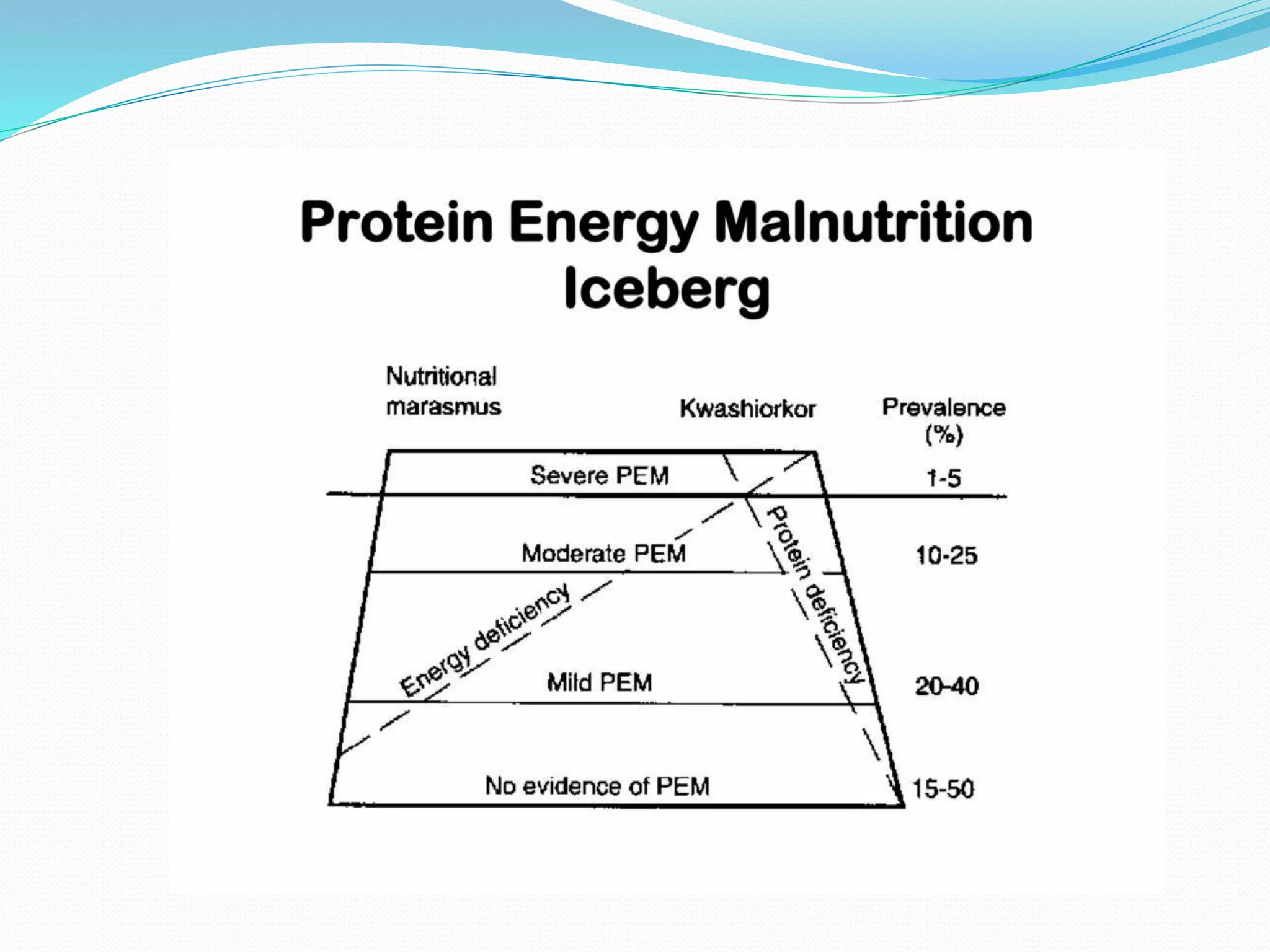 Protein energy malnutrition | PPTX