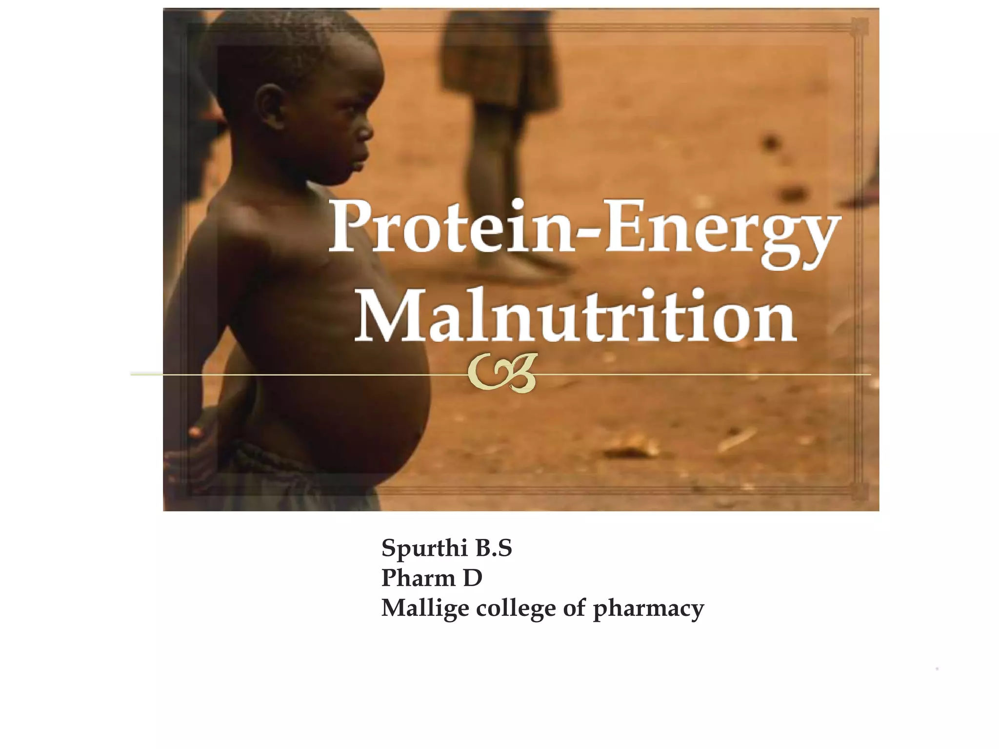 Protein energy malnutrition | PPTX