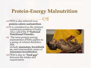 Protein energy malnutrition | PPTX