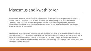 PROTEIN-ENERGY MALNUTRITION.pptx ghshsjj | PPTX | Diseases and ...