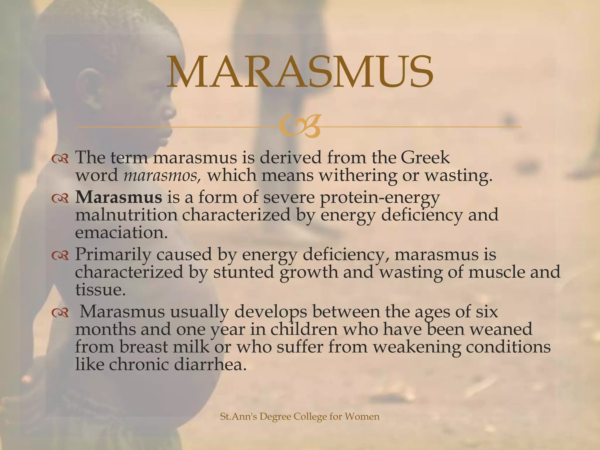 Protein Energy Malnutrition | PPTX