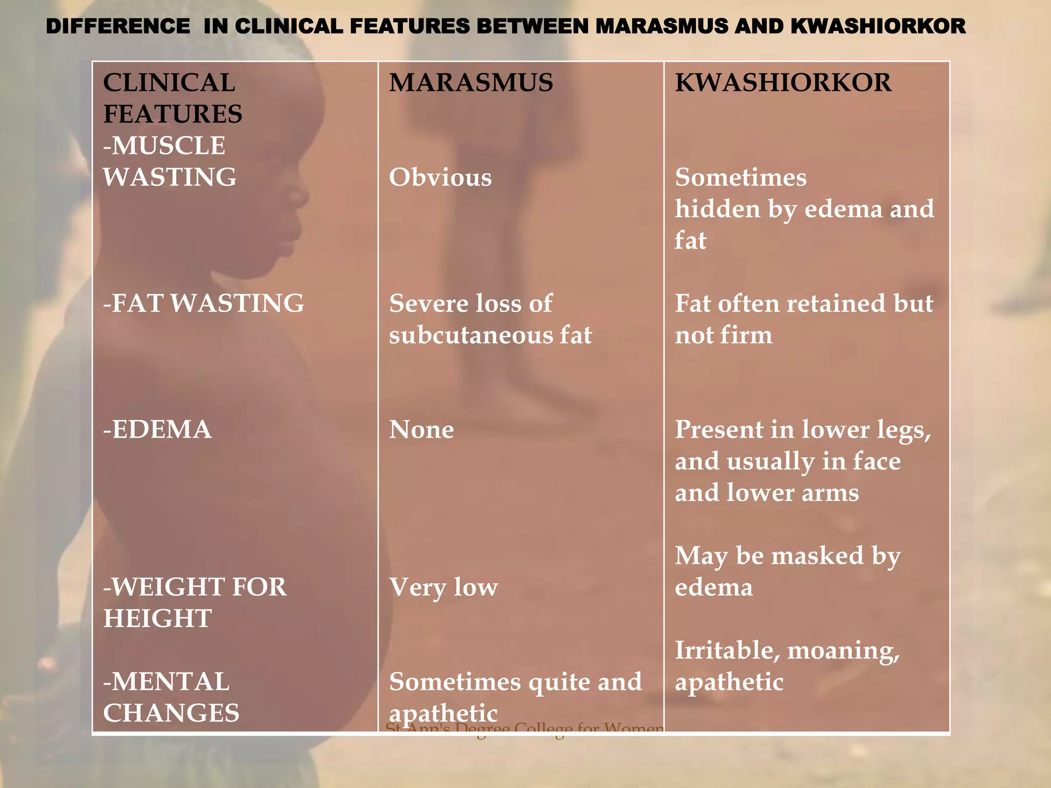 Protein Energy Malnutrition | PPTX