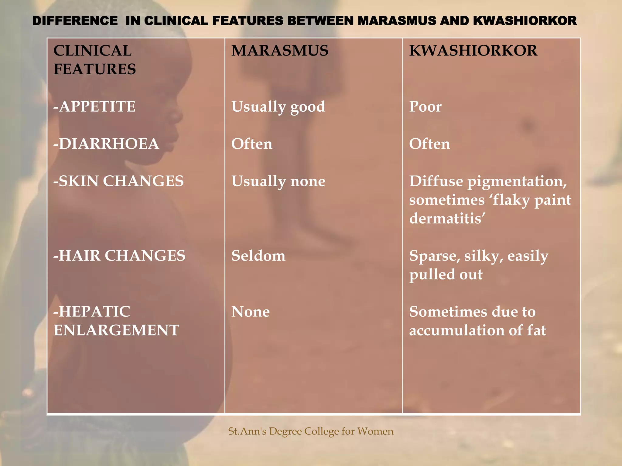 Protein Energy Malnutrition | PPTX