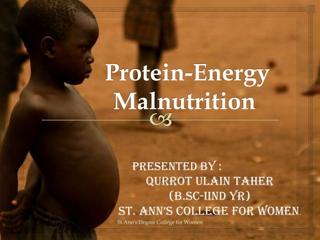 Protein Energy Malnutrition | PPTX | Nutrition | Healthy Living