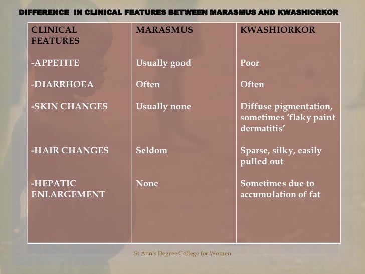 Protein Energy Malnutrition Symptoms Of Marasmus at Brodie Bolden blog