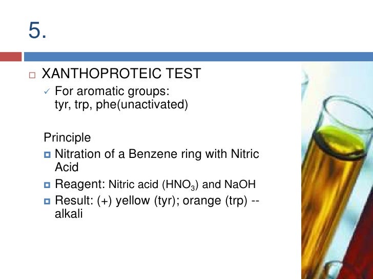 Sakaguchi Test Principle Reaction Reagents Procedure