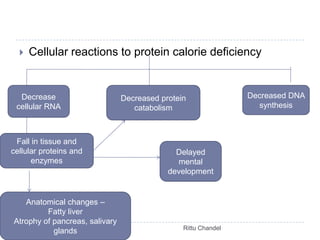 Protein energy malnutrition | PPTX
