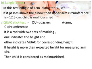 Protein energy malnutrition | PPT