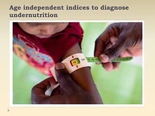 Protein energy malnutrition | PPTX