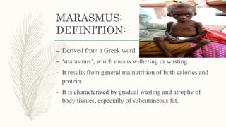 Protein energy malnutrition | PPTX