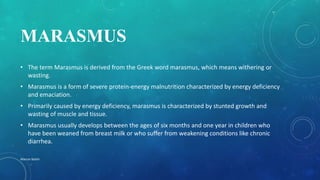 Protein energy malnutrition | PPT