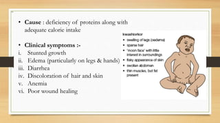 Protein energy malnutrition | PPTX