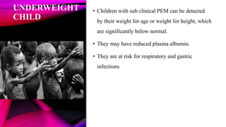 Protein energy malnutrition | PPTX