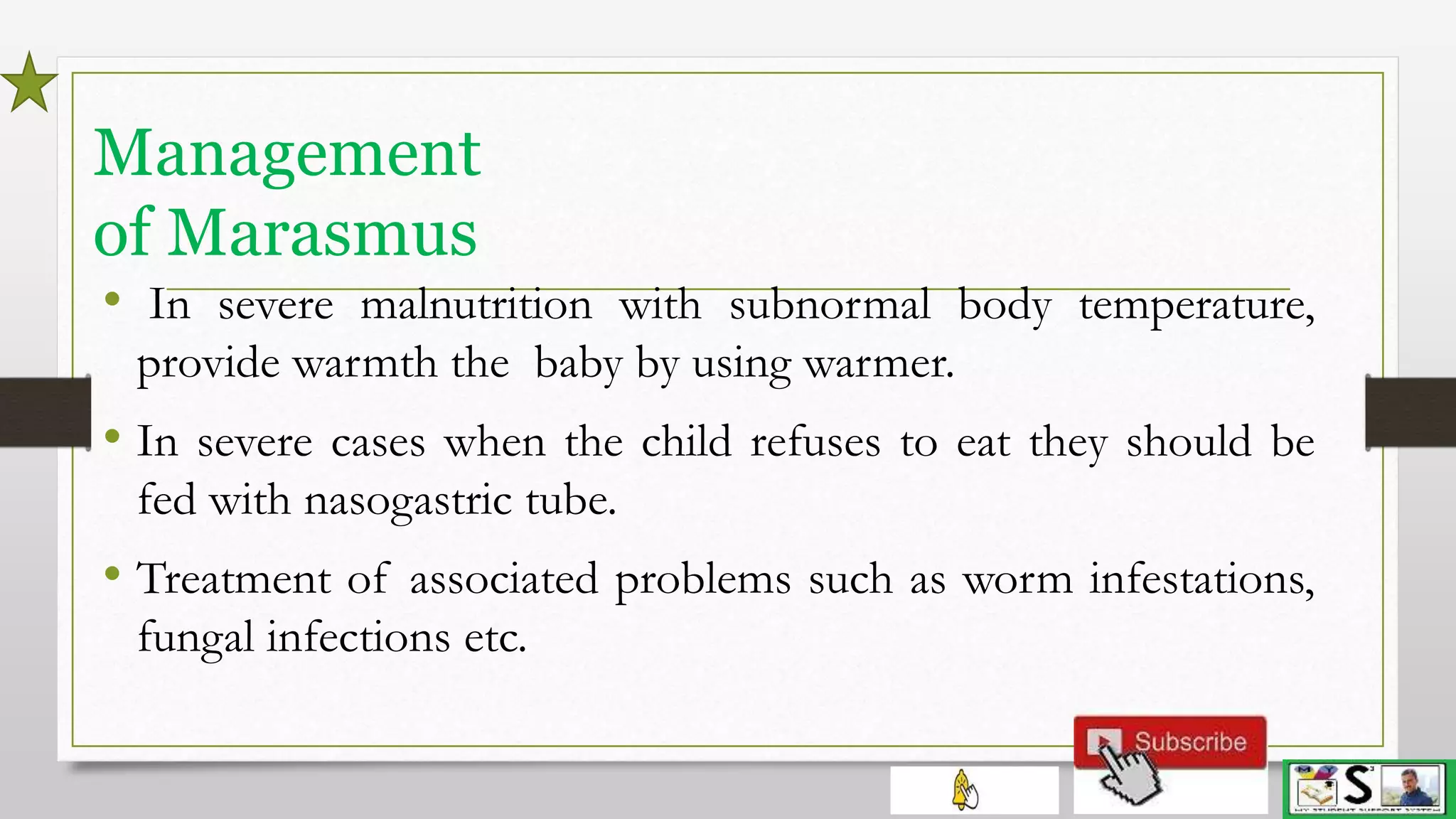 Protein energy malnutrition in children english | PPTX