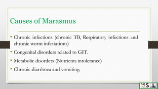 Protein energy malnutrition in children english | PPTX