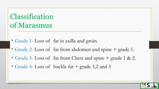 Protein energy malnutrition in children english | PPTX