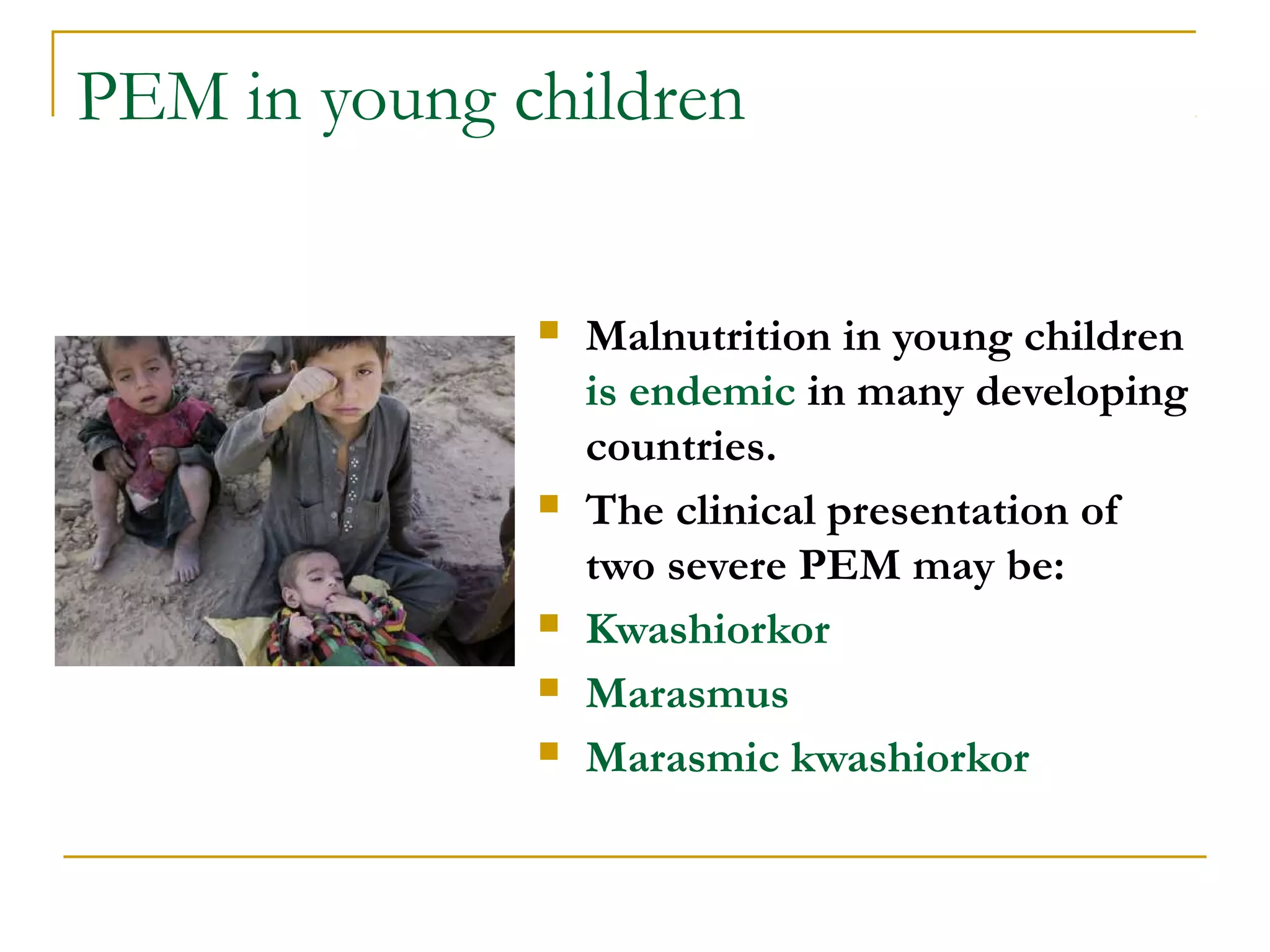 Protein Energy Malnutrition(PEM) | PPT