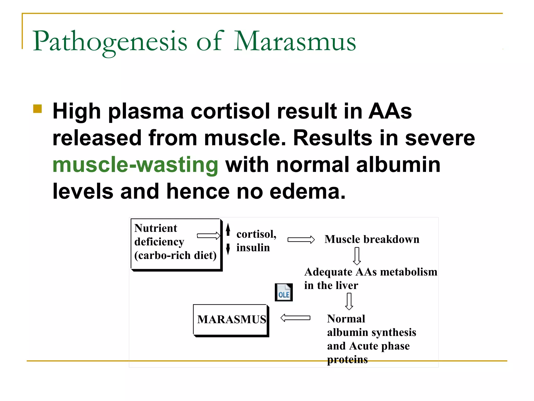 Protein Energy Malnutrition(PEM) | PPT