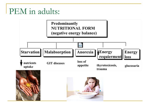Protein Energy Malnutrition(PEM) | PPT | Nutrition | Healthy Living
