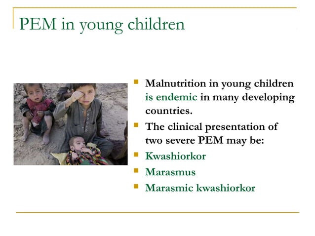 Protein Energy Malnutrition(PEM) | PPT | Nutrition | Healthy Living