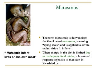 Protein Energy Malnutrition(PEM) | PPT