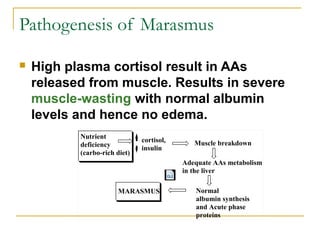 Protein Energy Malnutrition(PEM) | PPT