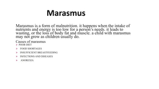 Protein energy malnutritions.pptx