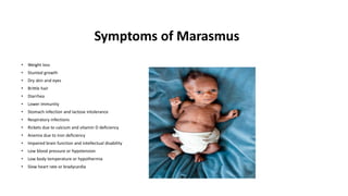 Protein energy malnutritions.pptx