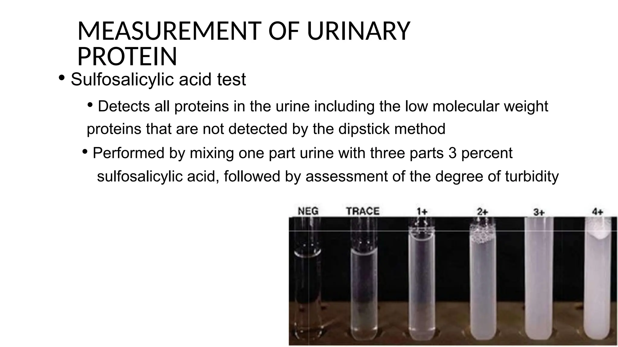 proteinuria presentation how on approach.pptx